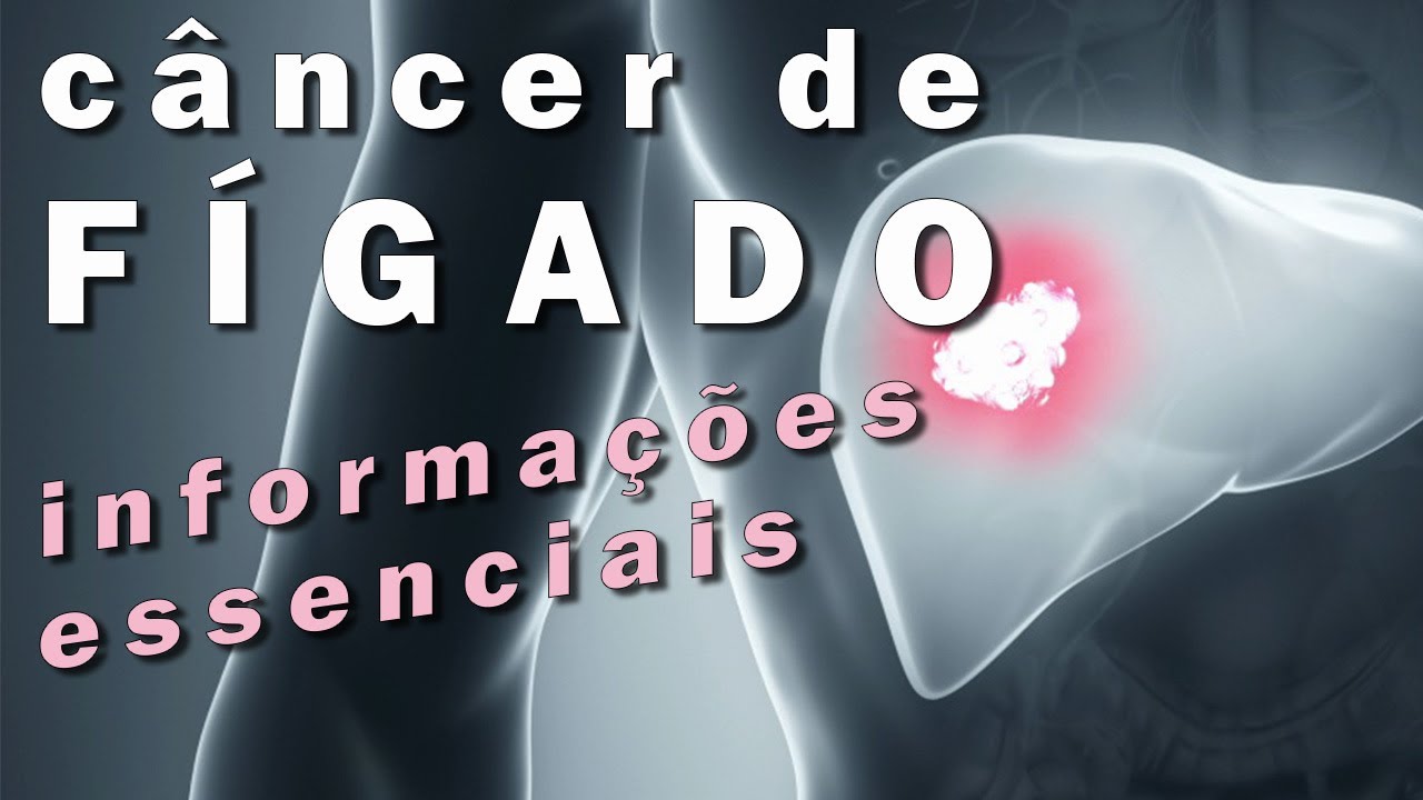 CÂNCER DE FÍGADO: tratamentos, prevenção e sintomas do câncer - YouTube