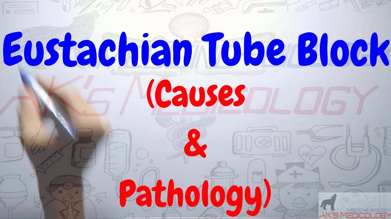 Eustachian Tube Block: Causes & Pathology (with clinical case) | AK's ...