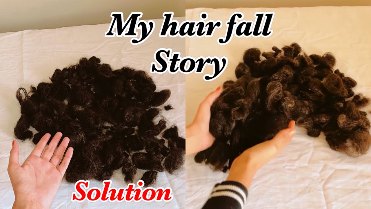 My Hair fall story 🥹 | How to control Hair fall | Solution for hair ...