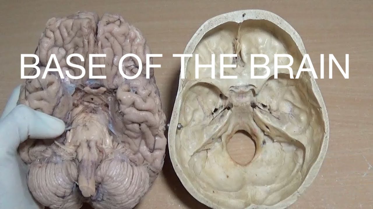 BASE OF THE BRAIN - DEMONSTRATION - ANATOMY - YouTube