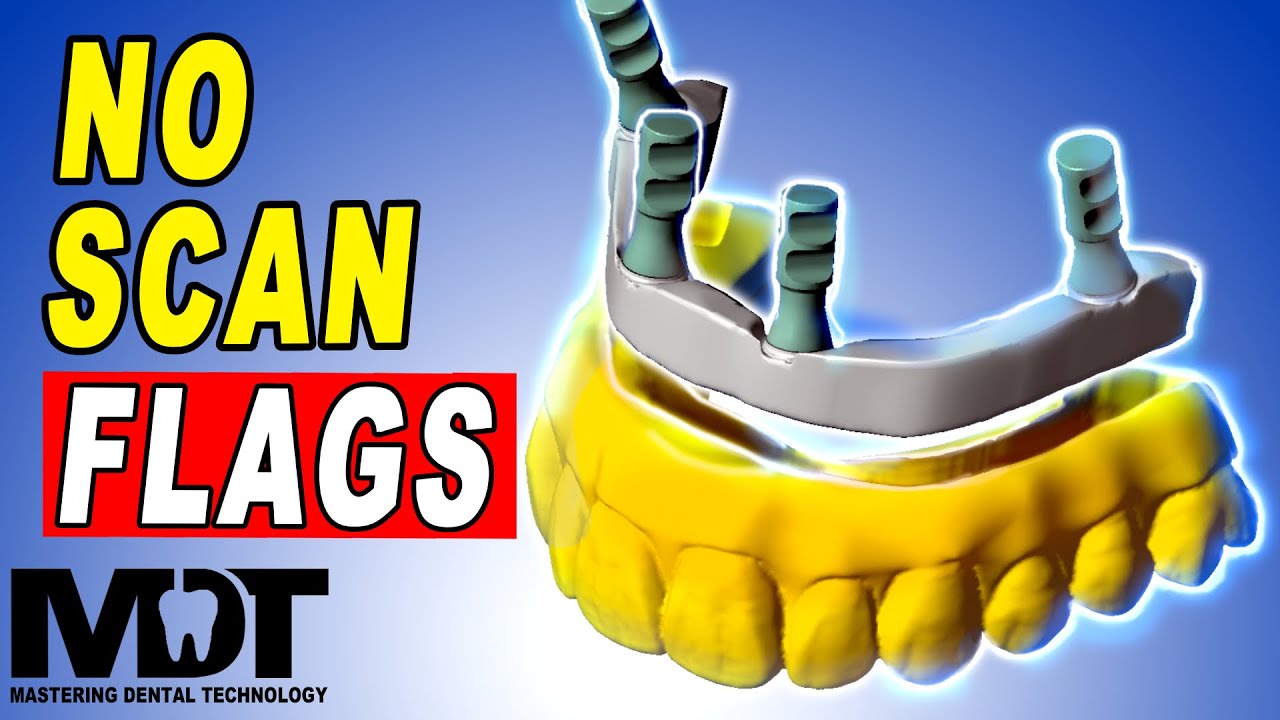 All On 4 Design with Screw Retained Bar Split File [ Exocad Tutorial ...