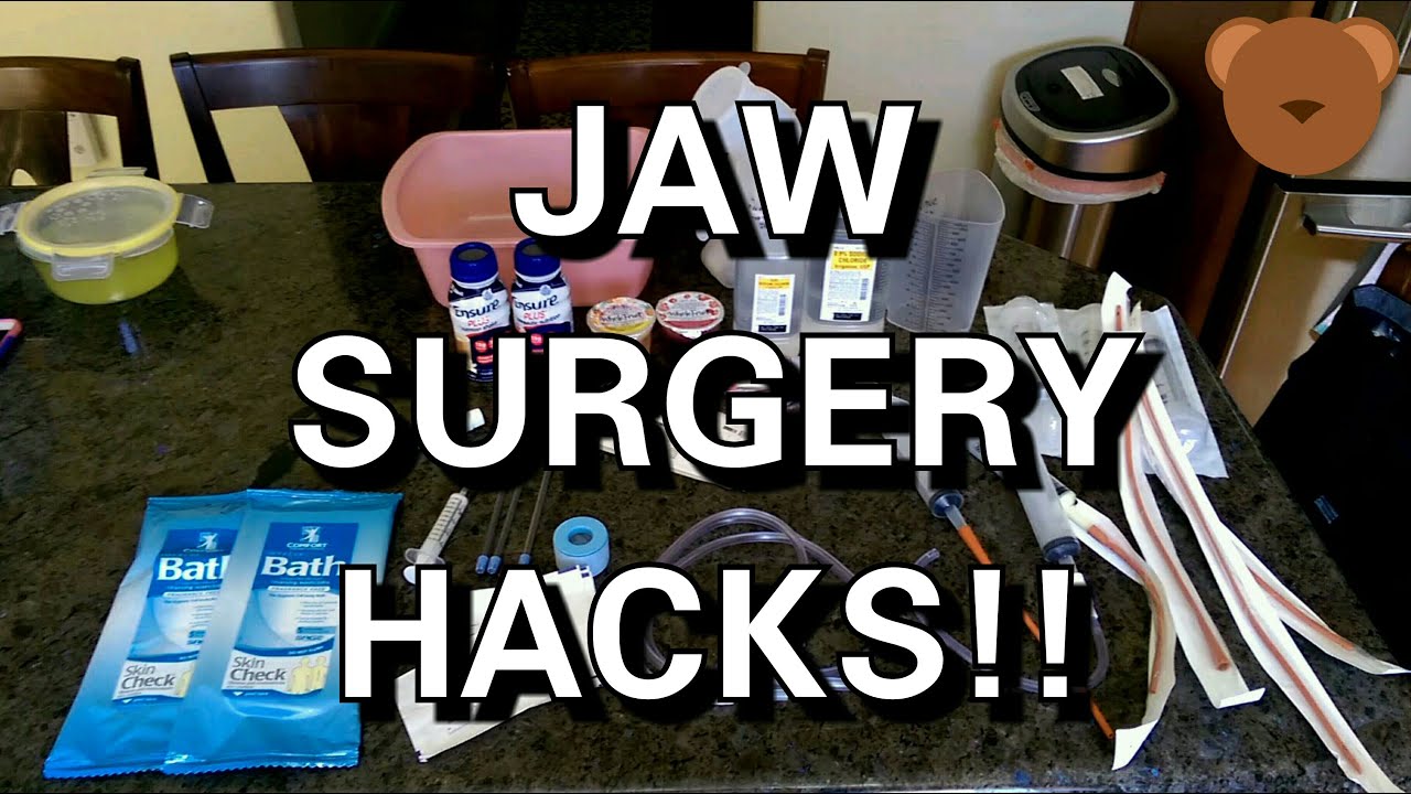 JAW SURGERY HACKS!! Crossbite/Underbite Jaw Surgery - YouTube