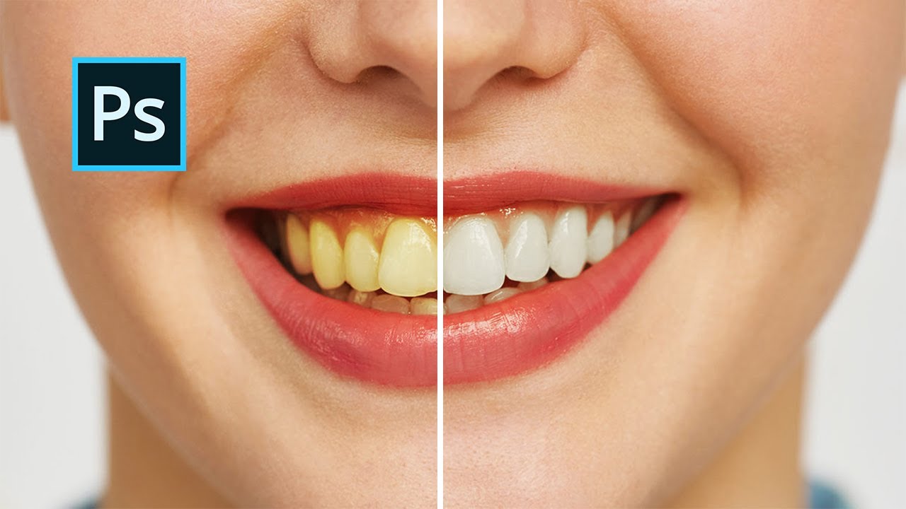 How to Yellow Teeth Make Whiten In photoshop I Photoshop Tutorial - YouTube