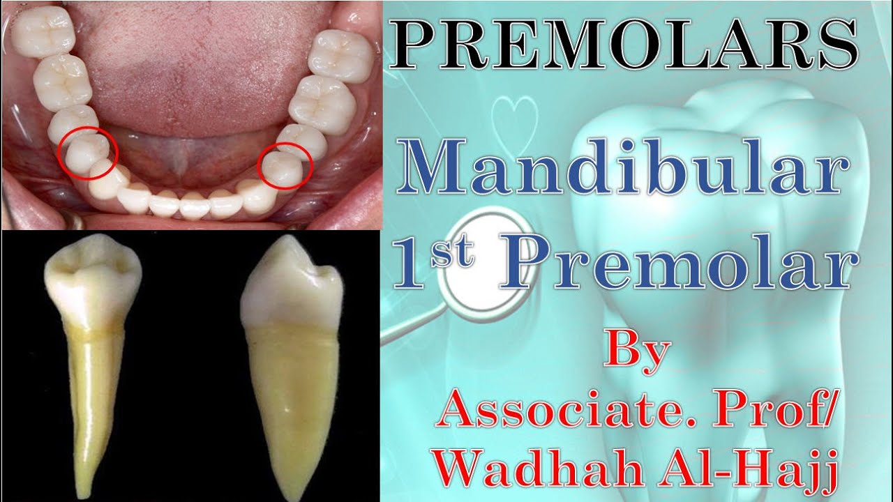 12- Premolars – Mandibular 1st premolars. Dr Wadhah Dental Anatomy ...