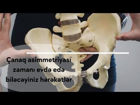 Çanaq asimmetriyası zamanı evdə edə biləcəyiniz idman hərəkətləri | Fizioterapevt Aziz Davrishov 