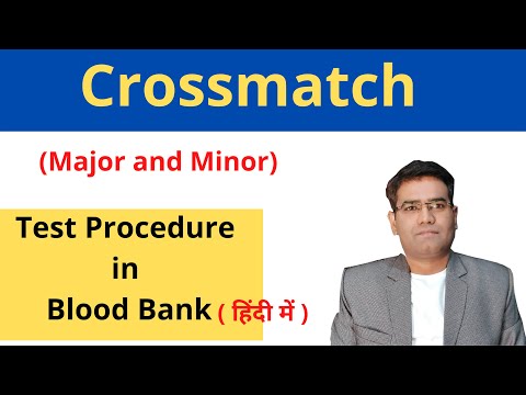 Crossmatch blood test, crossmatch procedure in blood bank explained ...
