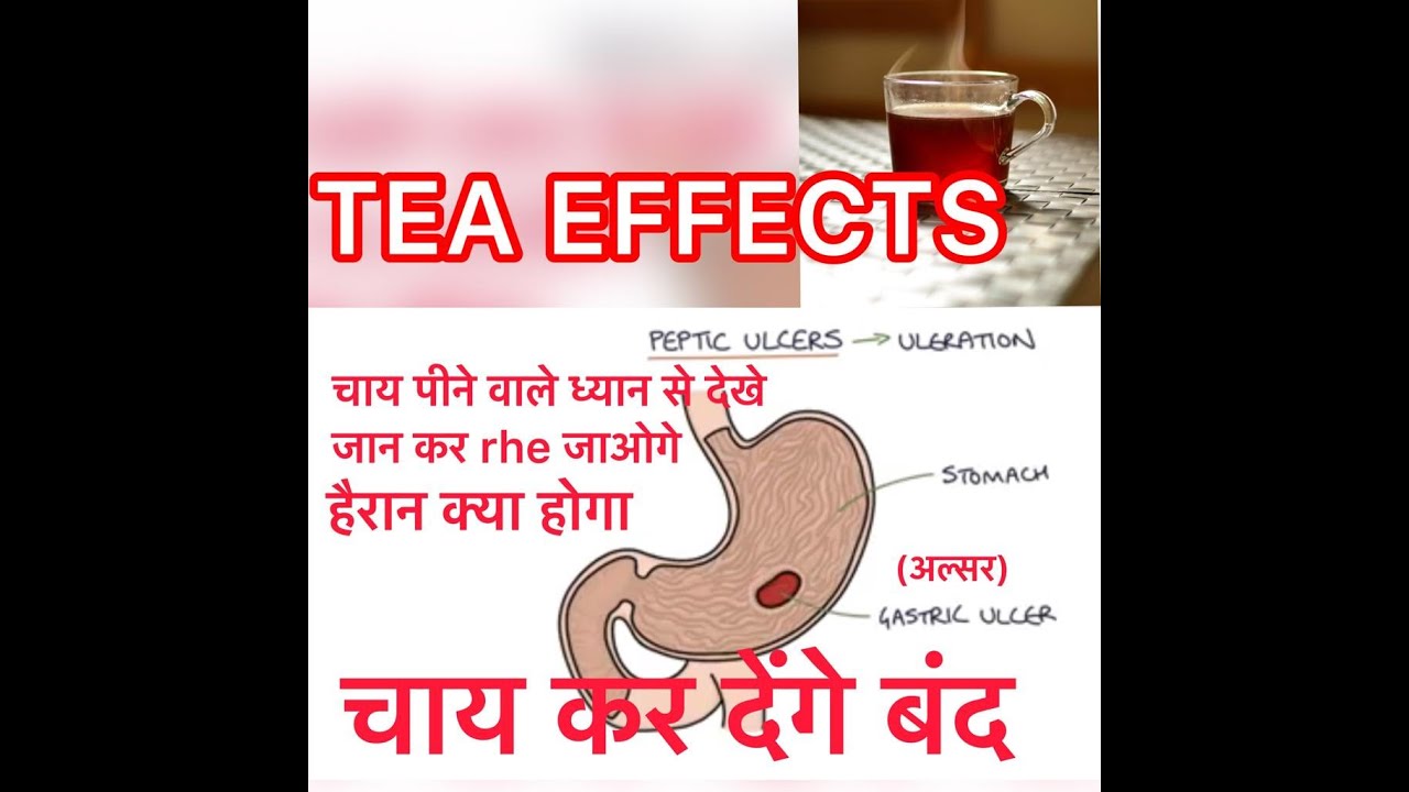 चाय पीने के नुक़सान सुनकर चोक जयेगे आप !!!! Side effects of tea ...