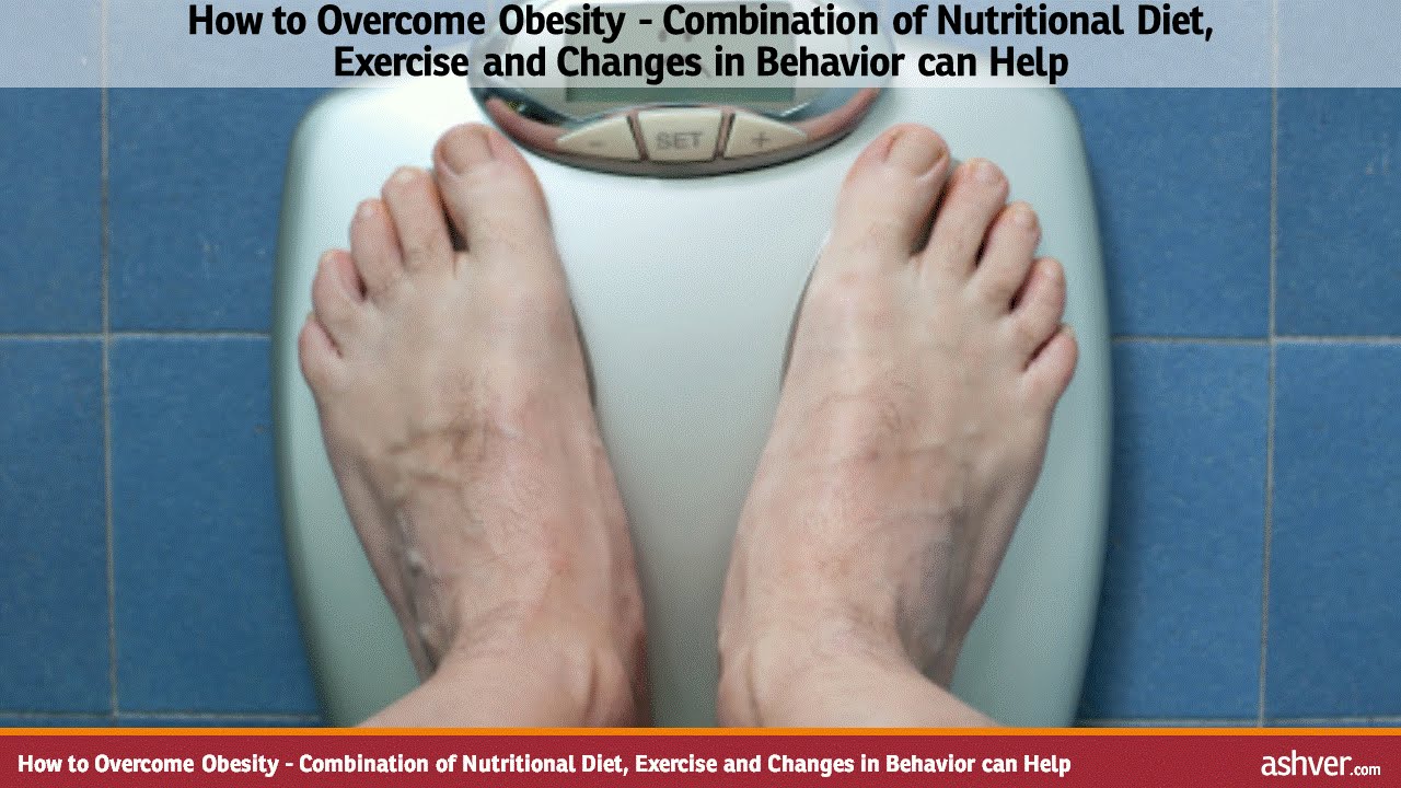 How to Overcome Obesity - Combination of Nutritional Diet, Exercise and ...