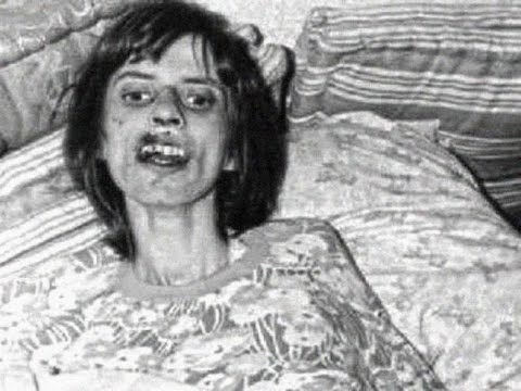 İçine Şeytan Girdiği Düşünülen Kız ve İlginç Ölümü - Anneliese Michel
