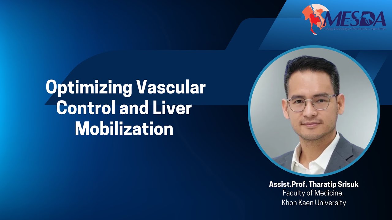 Optimizing Vascular Control and Liver Mobilization from Assist.Prof ...