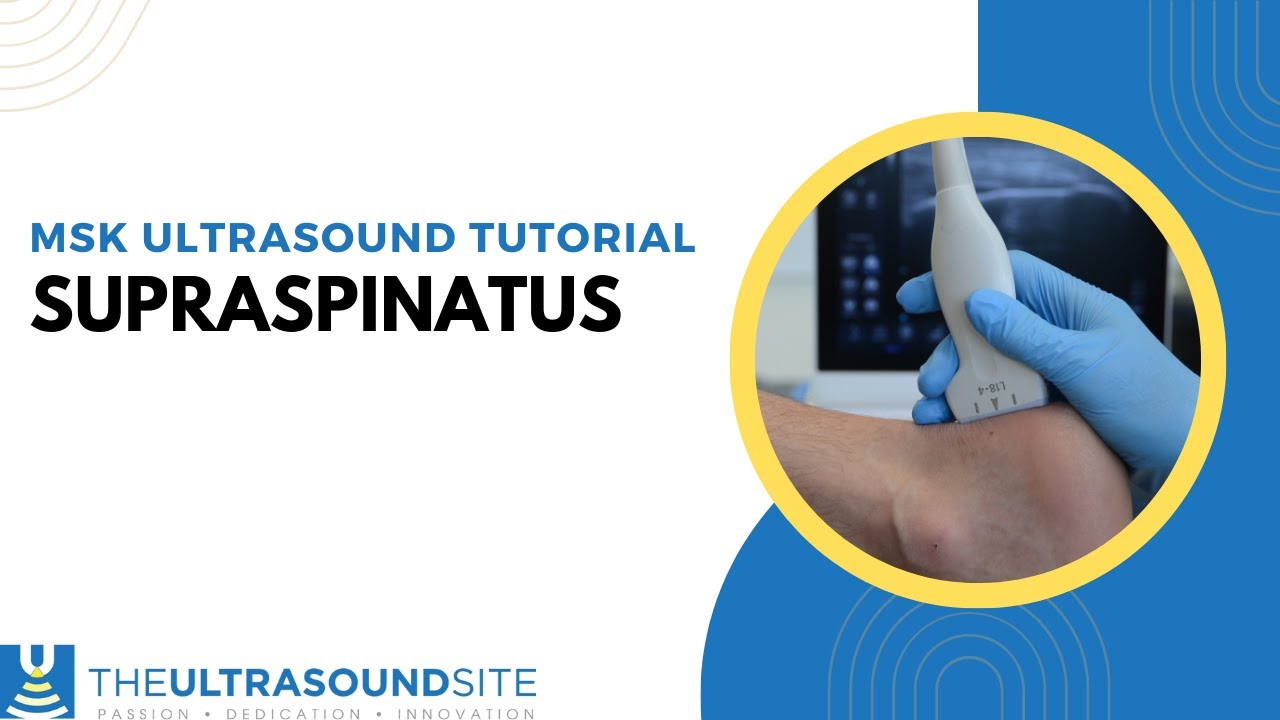 Supraspinatus Tendon Tear Ultrasound Supraspinatus Tendon Tear Ultrasound