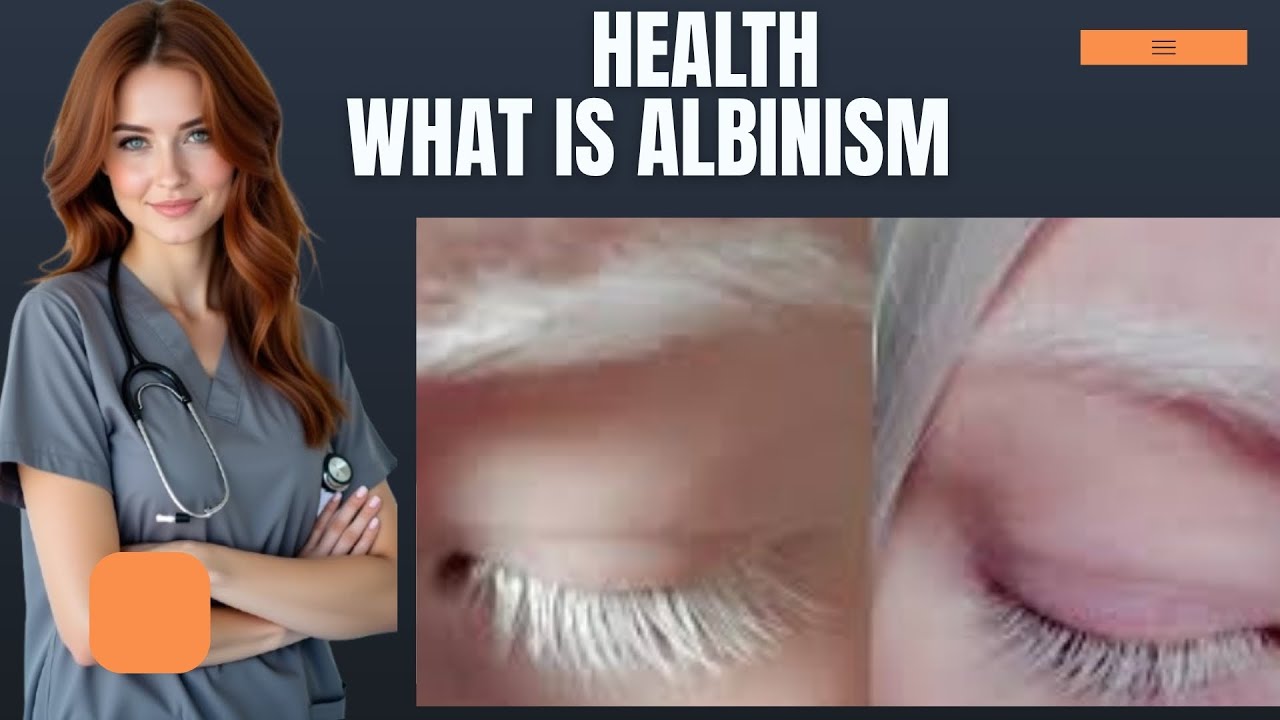 What Is Albinism - YouTube