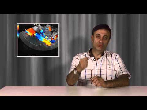 Hamilelikte renkli Doppler ultrason niçin yapılır?