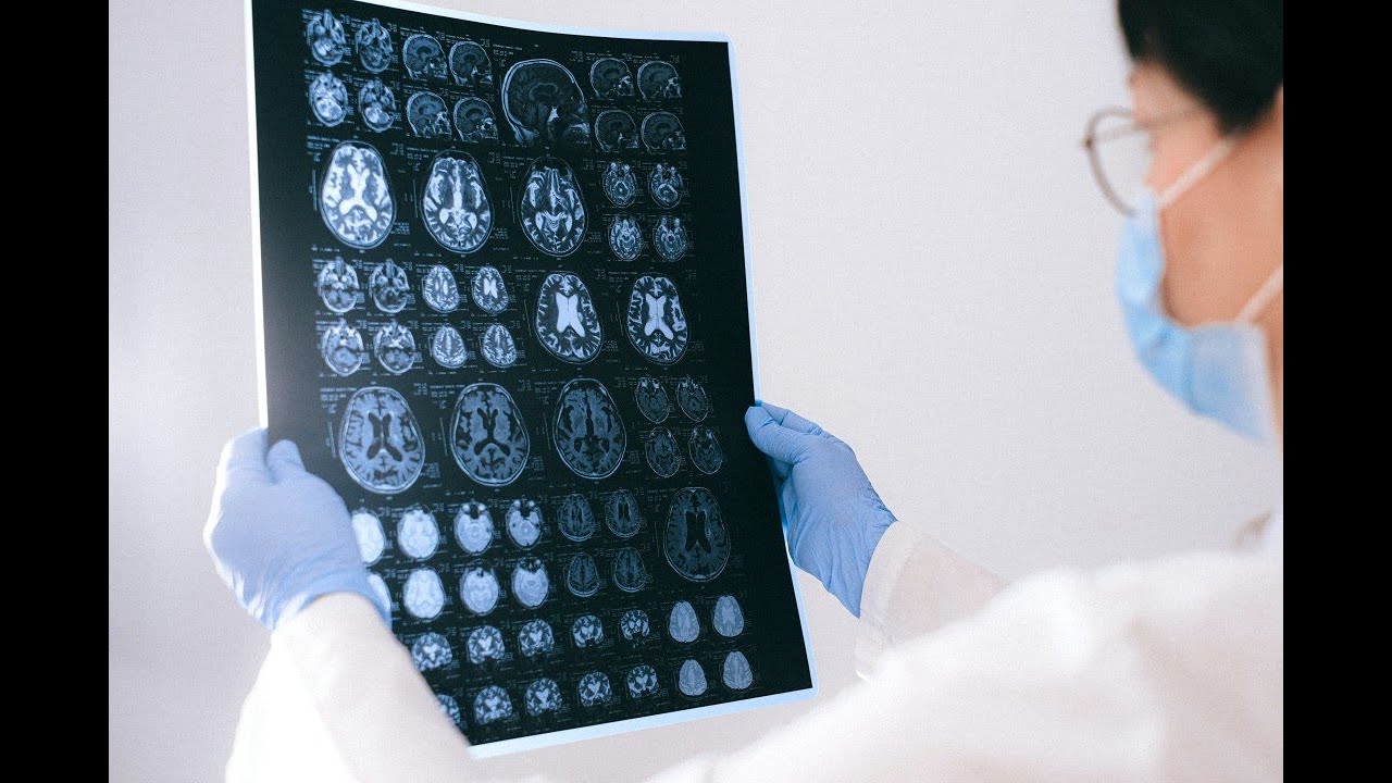 Diagnosis of Aminoff Suffering Syndrome in Advanced Alzheimer’s Disease ...