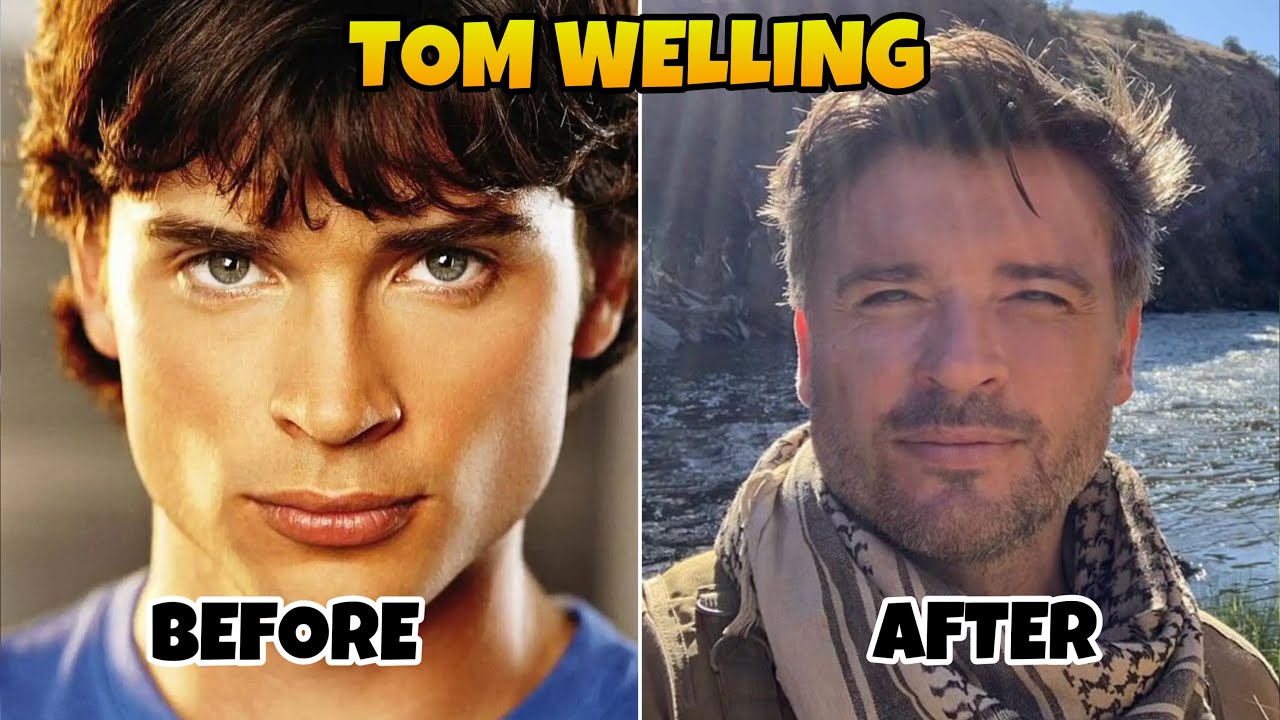 👉 Tom Welling SMALLVILLE 🔥 Before and After - YouTube