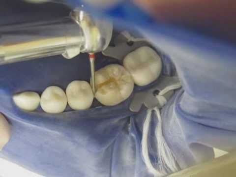 Retention and Convenience Forms - YouTube