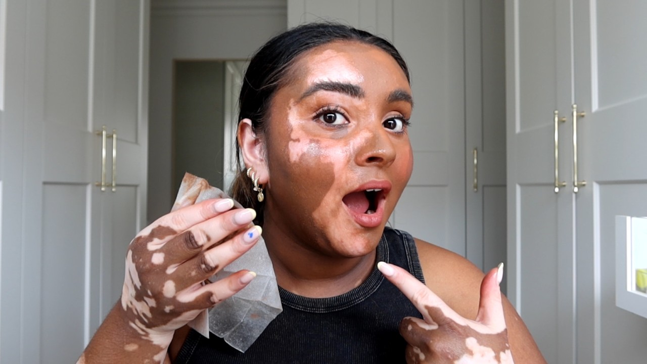 ATTEMPTING TO COVER MY VITILIGO... AGAIN - YouTube