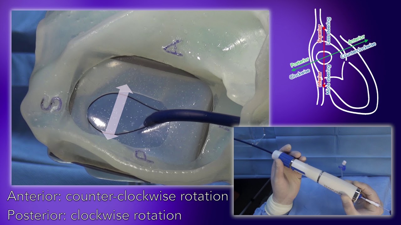 Transseptal Solutions TSP Crosser - YouTube