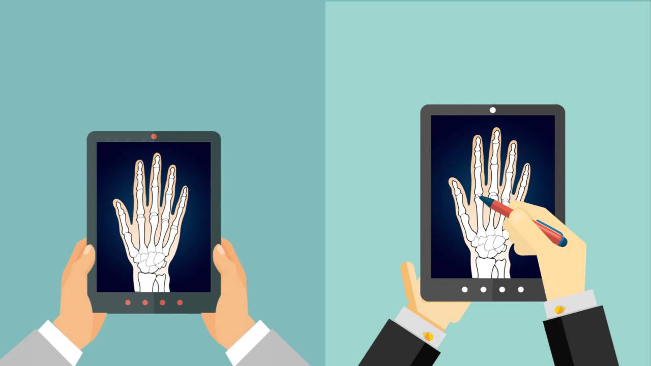 Thinksmart Whiteboard cartoon commercial02 - YouTube