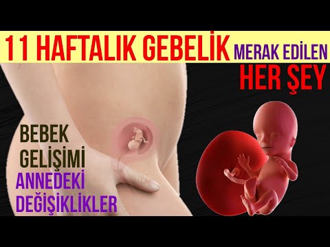 11 Haftalık Gebelik (2025)