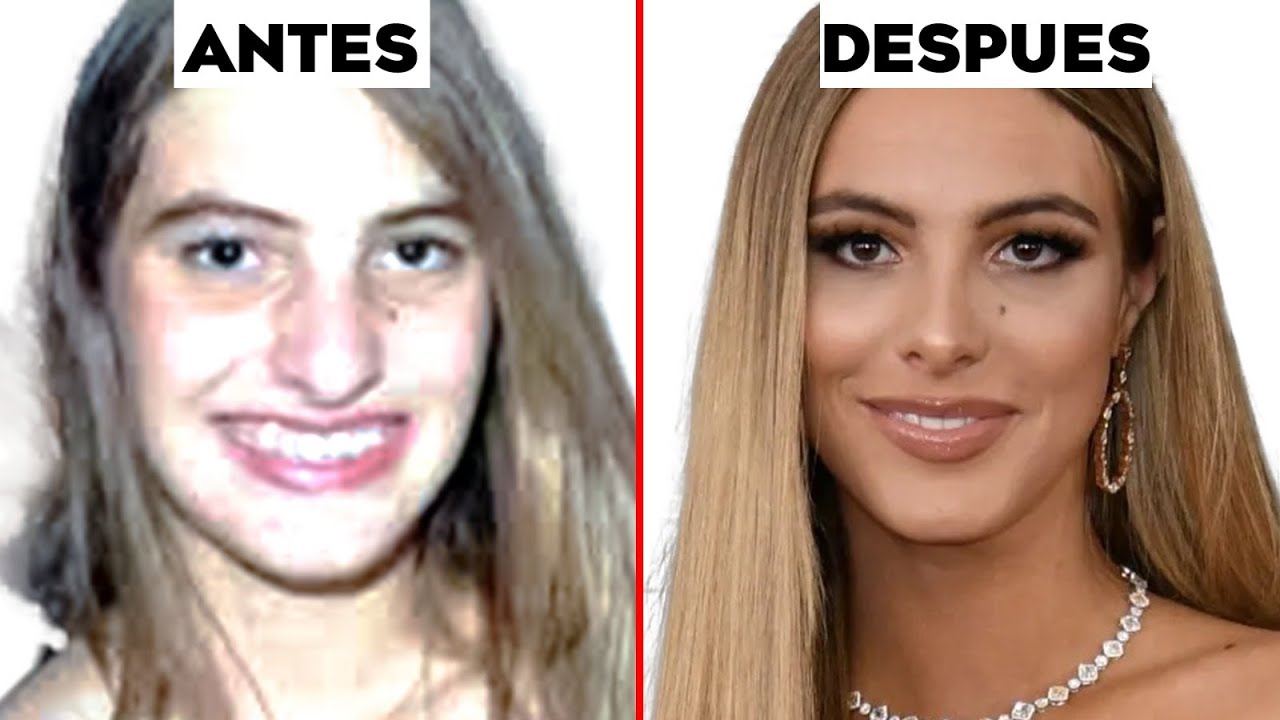 Qué se HIZO LELE PONS en el ROSTRO Impactante TRANSFORMACIÓN FACIAL ...