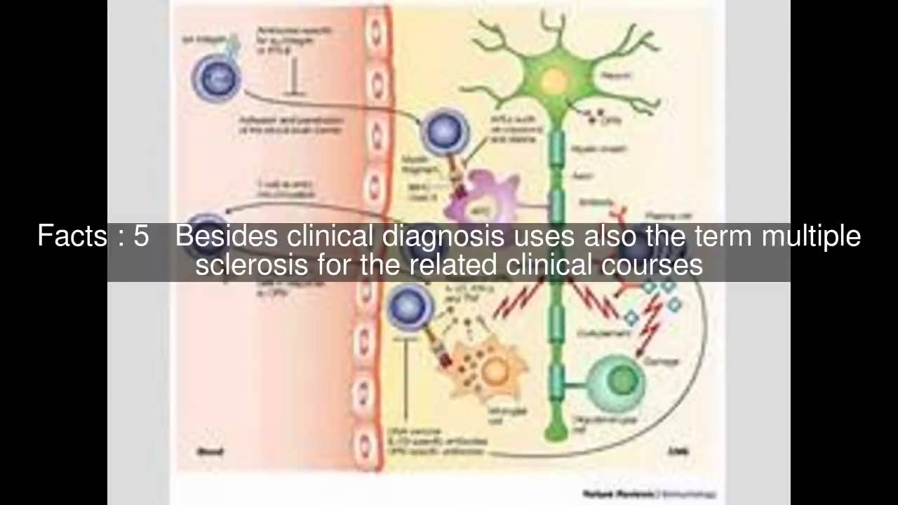Pathology of multiple sclerosis Top #8 Facts - YouTube