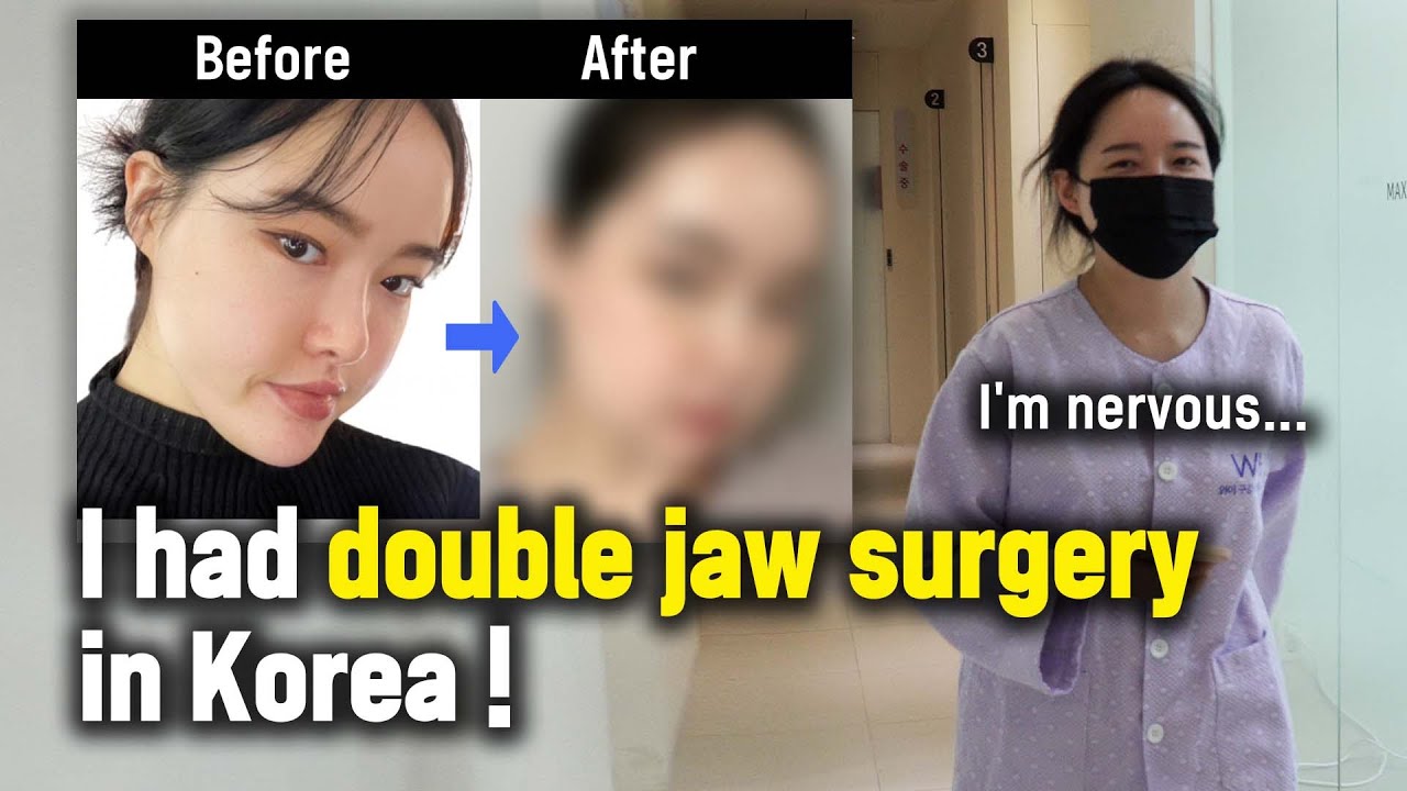 [EN/JP] I had double jaw surgery In Korea l Vlog - YouTube