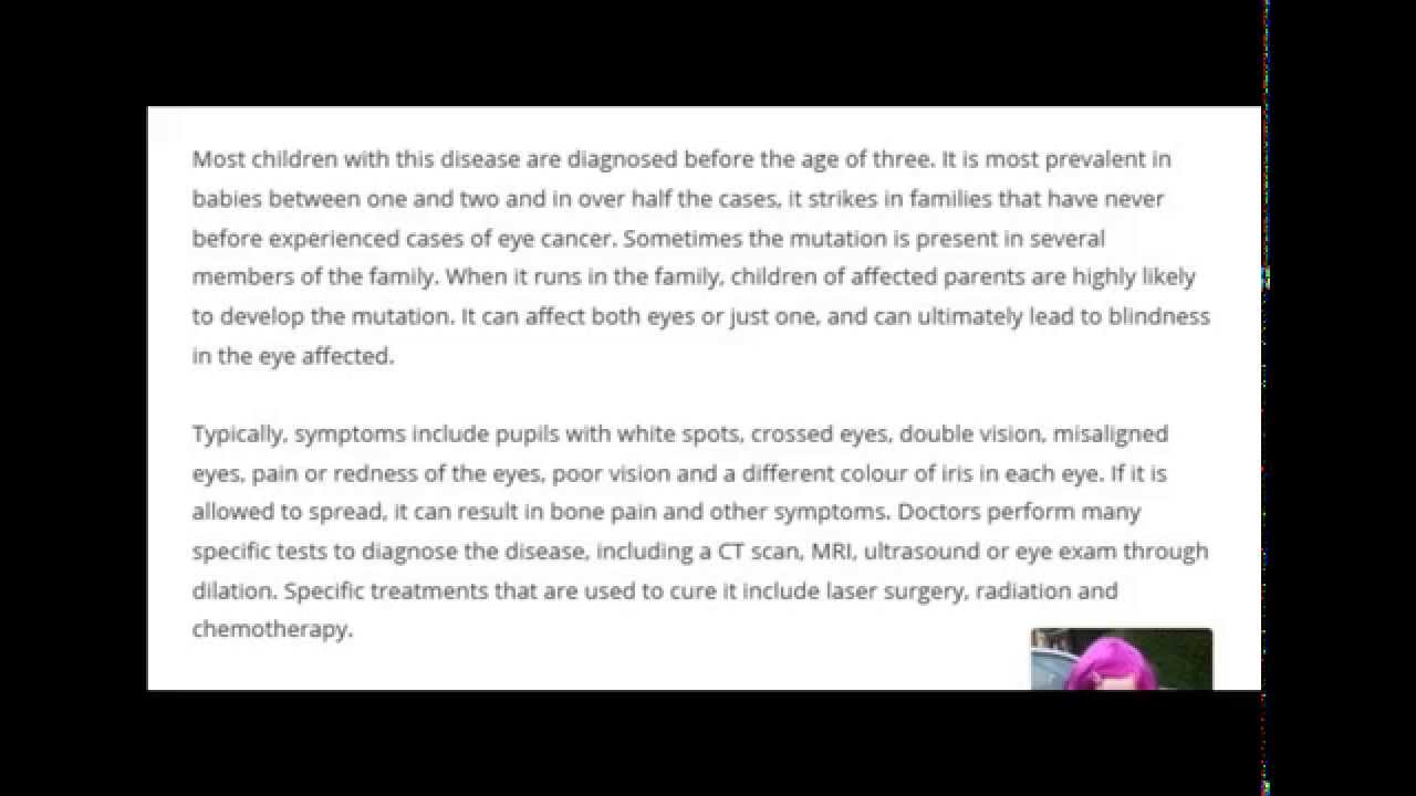 Brian Barso | What is Retinoblastoma - YouTube