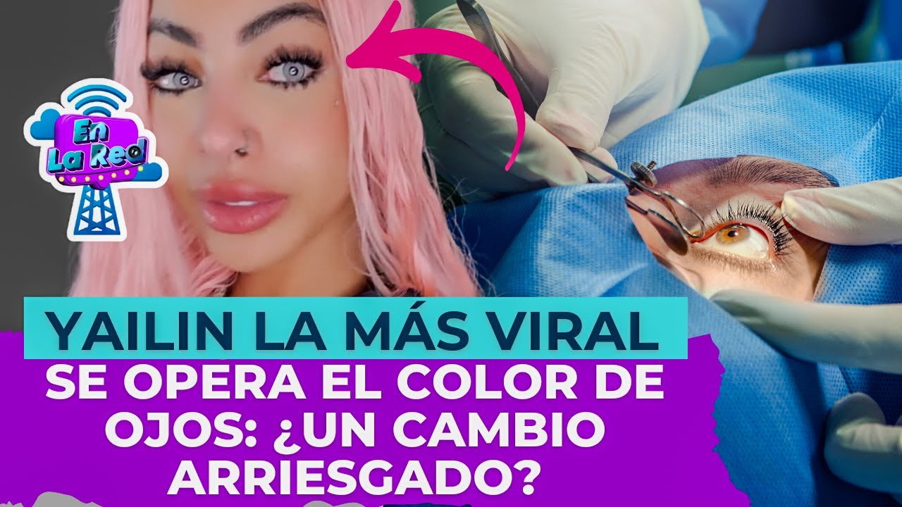 Yailin La Más Viral Se Opera el Color de Ojos: ¿Un Cambio Arriesgado ...