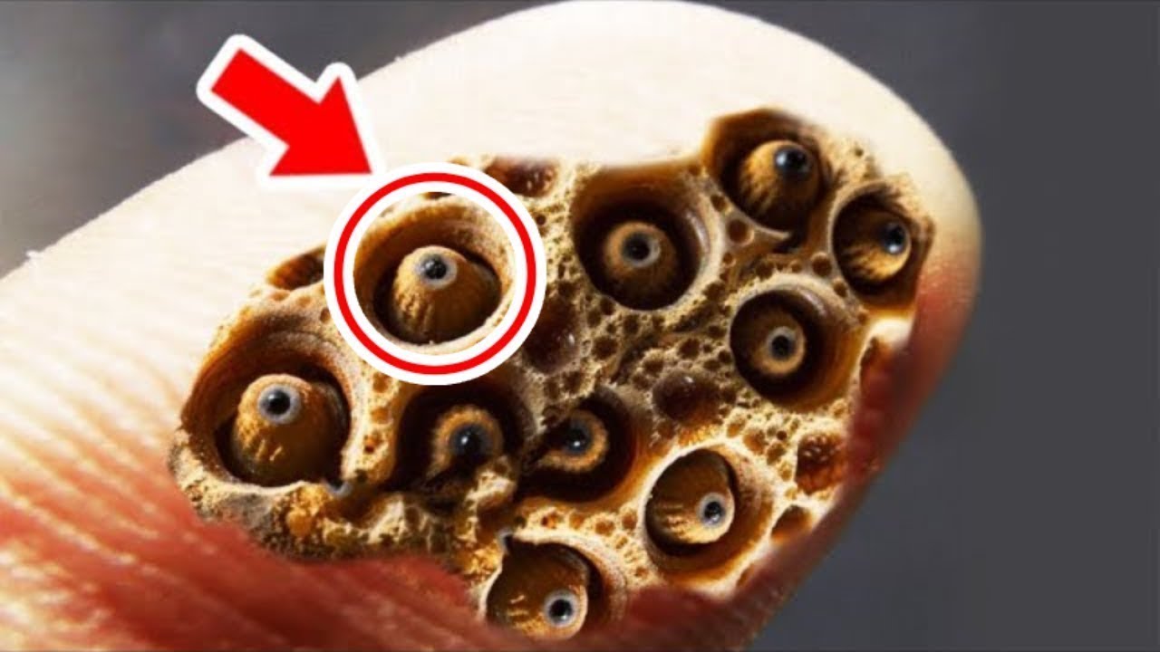 Weird Circle Appears on His Finger… Doctors Take One Look and Dial 911 ...