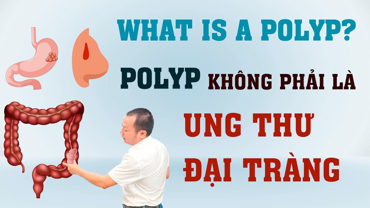 What Is A Polyp? - Polyp Không Phải Là Ung Thư Đại Tràng #SứcKhỏe - YouTube