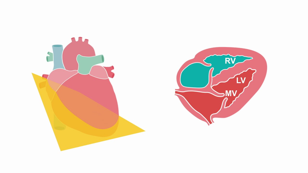 Learning how to acquire the four basic ECHO views when performing Point ...