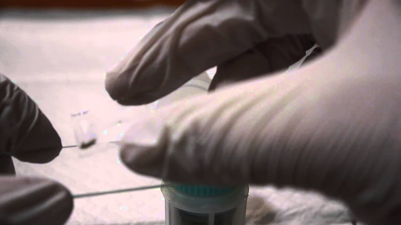 How to Do a Chameleon Fecal Float - YouTube