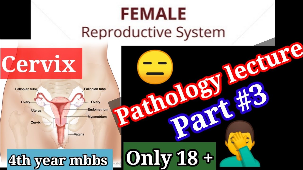 Special pathology lectures. Female Reproductive system part #3 Pathology for mbbs 4th year # ...