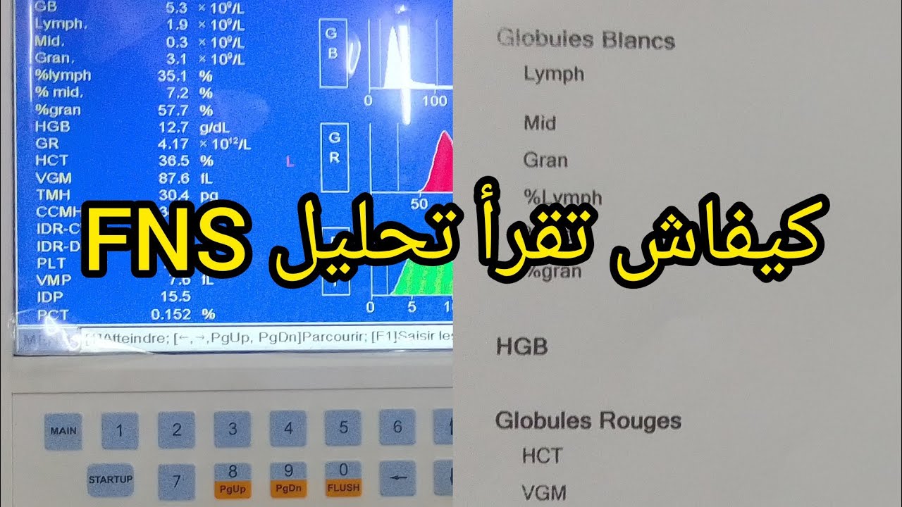 كيفاش تقرأ تحليل FNS complète..تحليل تعداد الدم الشامل - YouTube