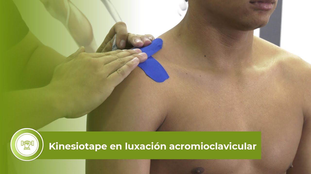 Kinesiotape en luxación acromioclavicular - YouTube