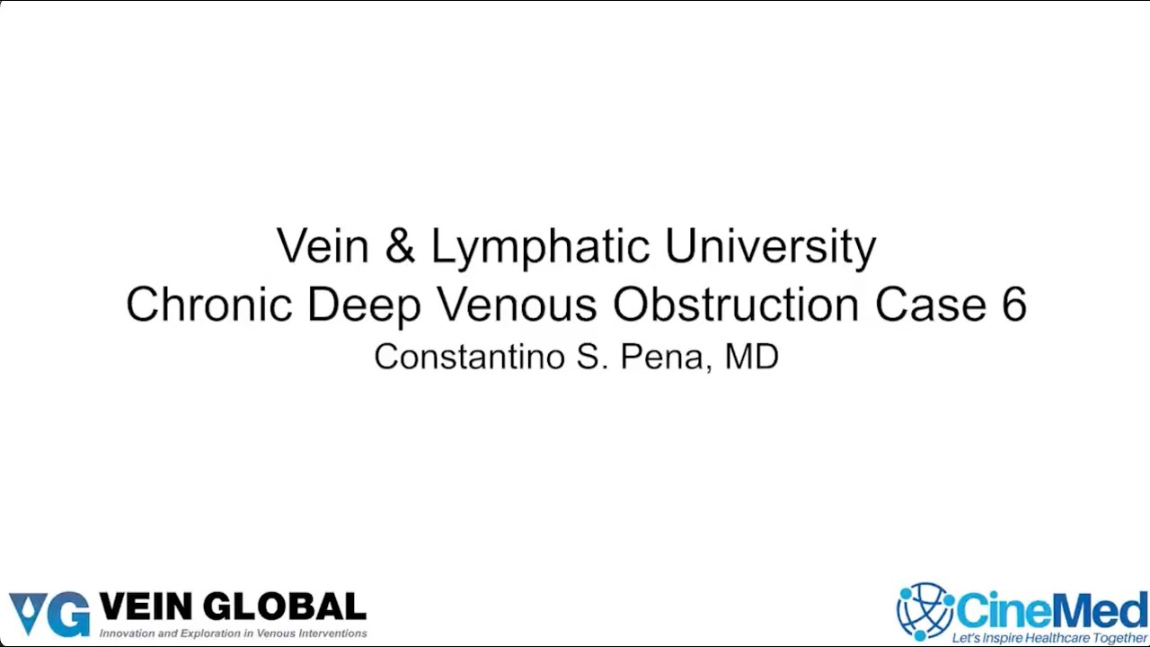 Vein & Lymphatic University: Chronic Deep Venous Obstruction Case 6 ...