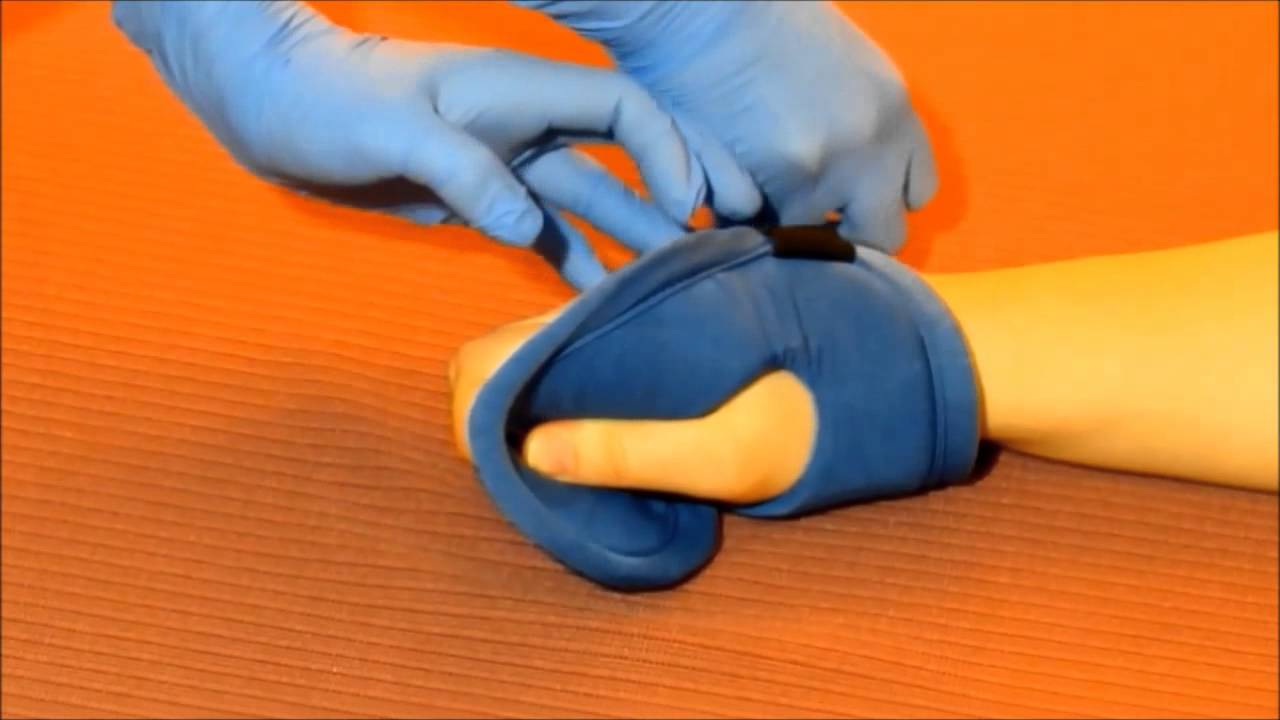 Ventopedic Palm Protector Demonstration - YouTube