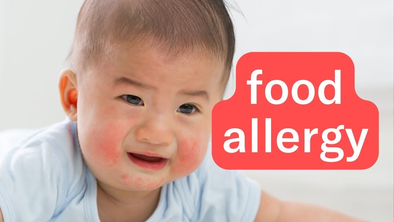 BABY FOOD | What are babies allergic to? - YouTube