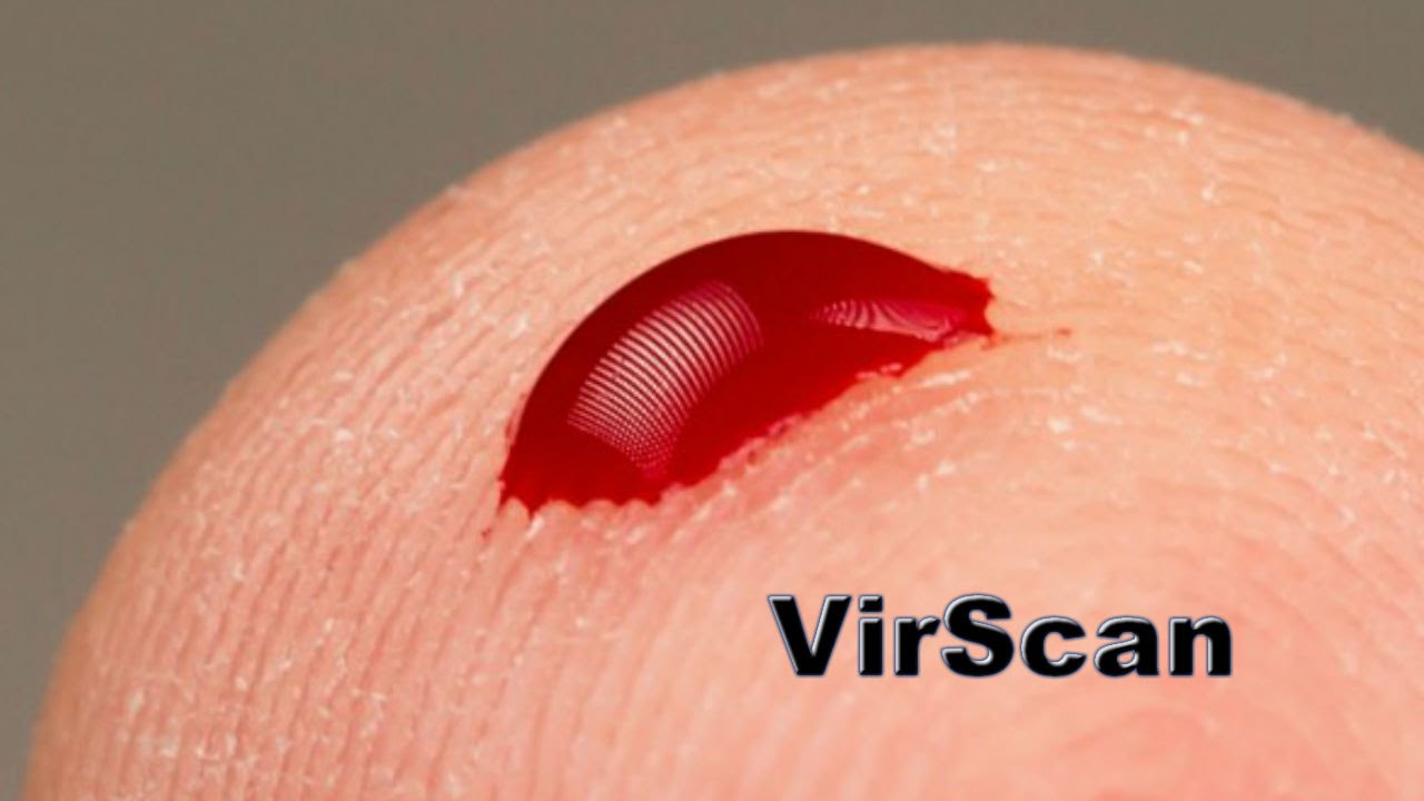 Single blood test "VirScan" can tell you every virus you’ve ever had ...