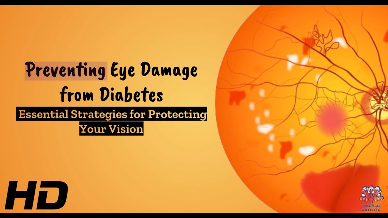 Eye Damage from Diabetes: Vital Tips for Vision Protection - YouTube