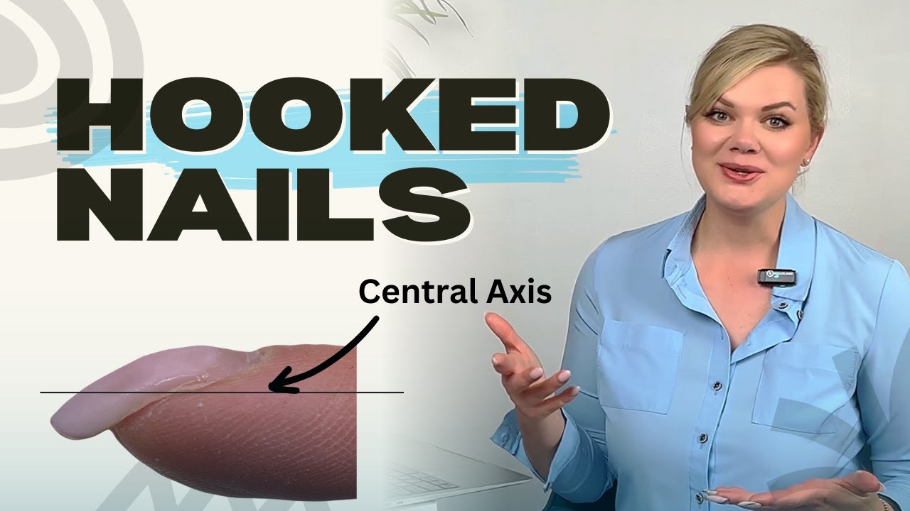 How to fix hooked nails ? Natural Nails are growing down - YouTube