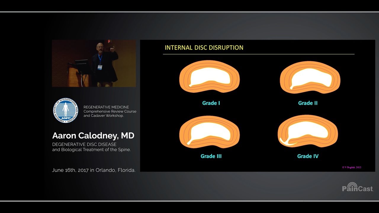 PREVIEW: Aaron Calodney, MD, ABIPP, FIPP Lecture: Biological Treatment ...