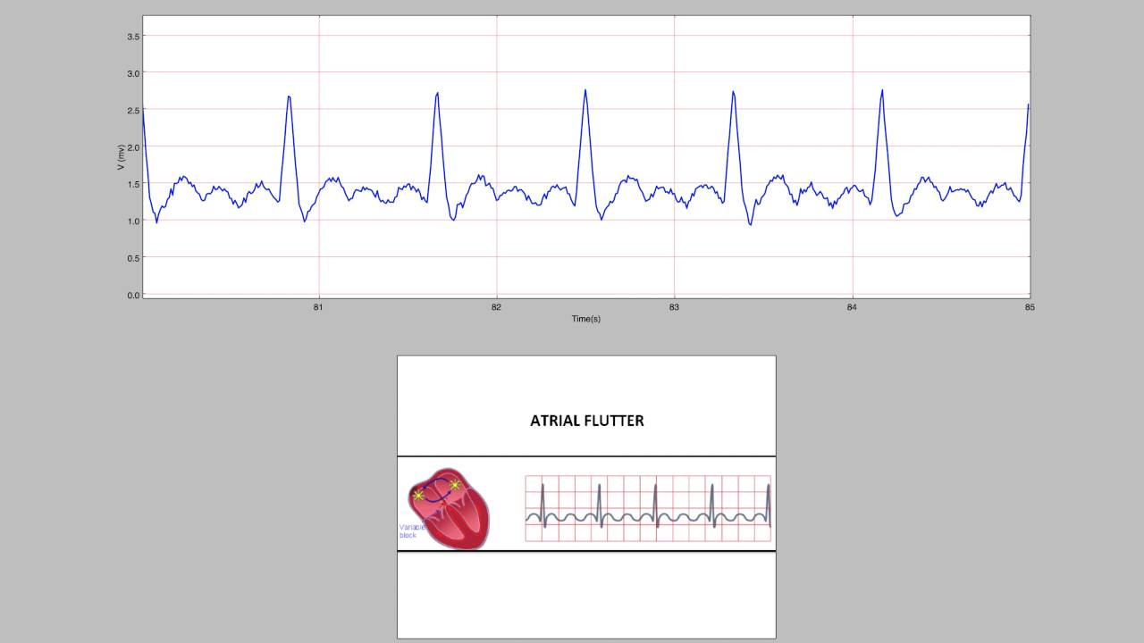 RT-ECG-Mon - YouTube