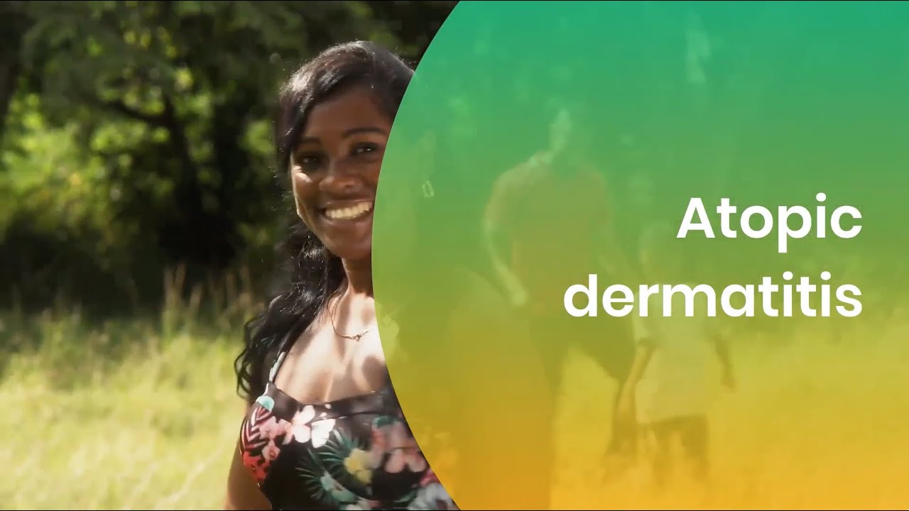 Eczema (Atopic Dermatitis) in Skin of Color: Black Skin, Brown Skin ...