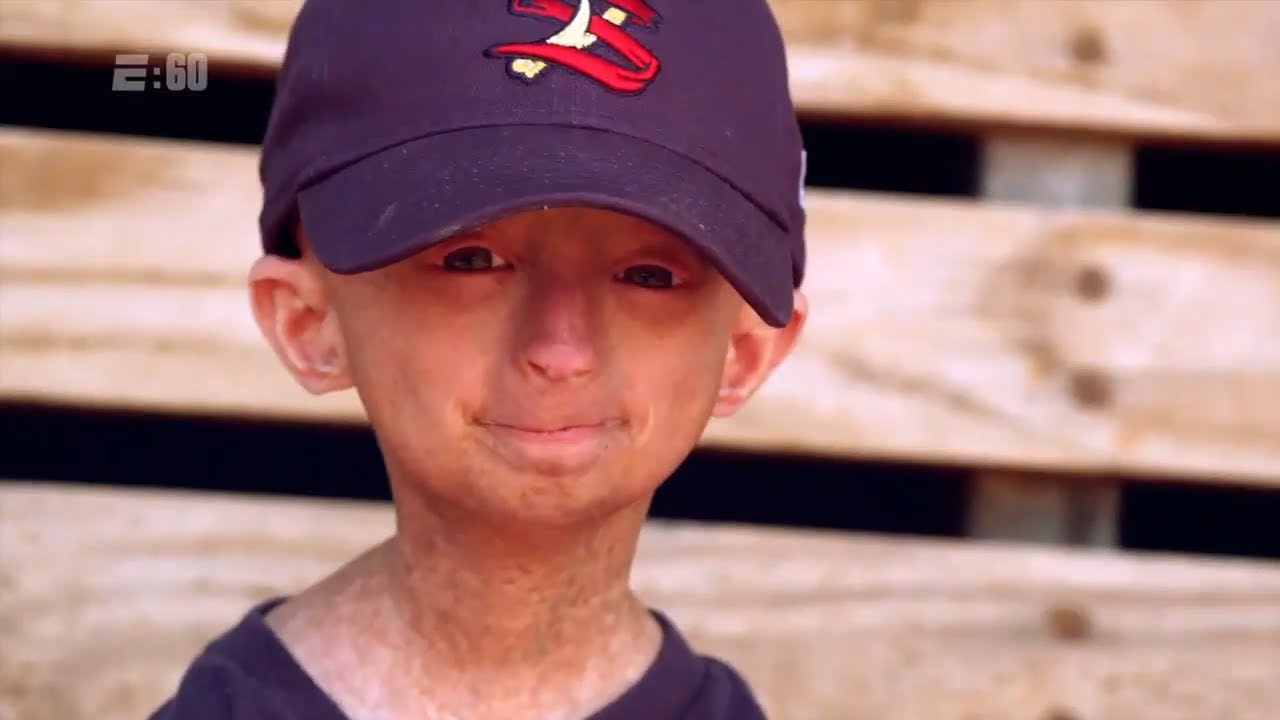 Josiah Viera’s love of baseball and love of life continues to inspire ...