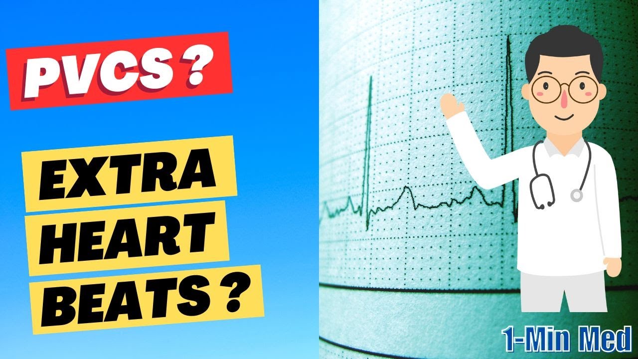 PVCs - Premature Ventricular Contractions - What You Need To Know - YouTube