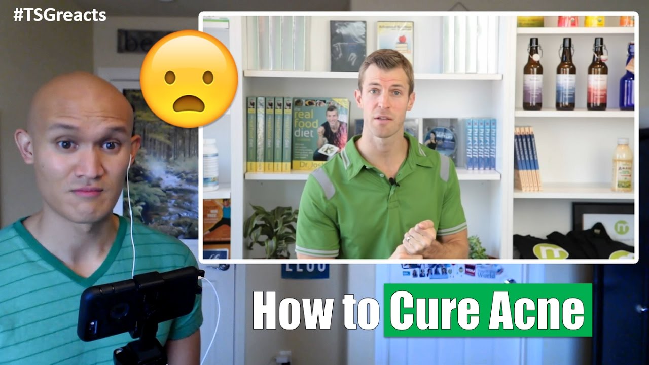 How to Cure Acne: 4 Secrets to Naturally Getting Rid of Acne Forever ...