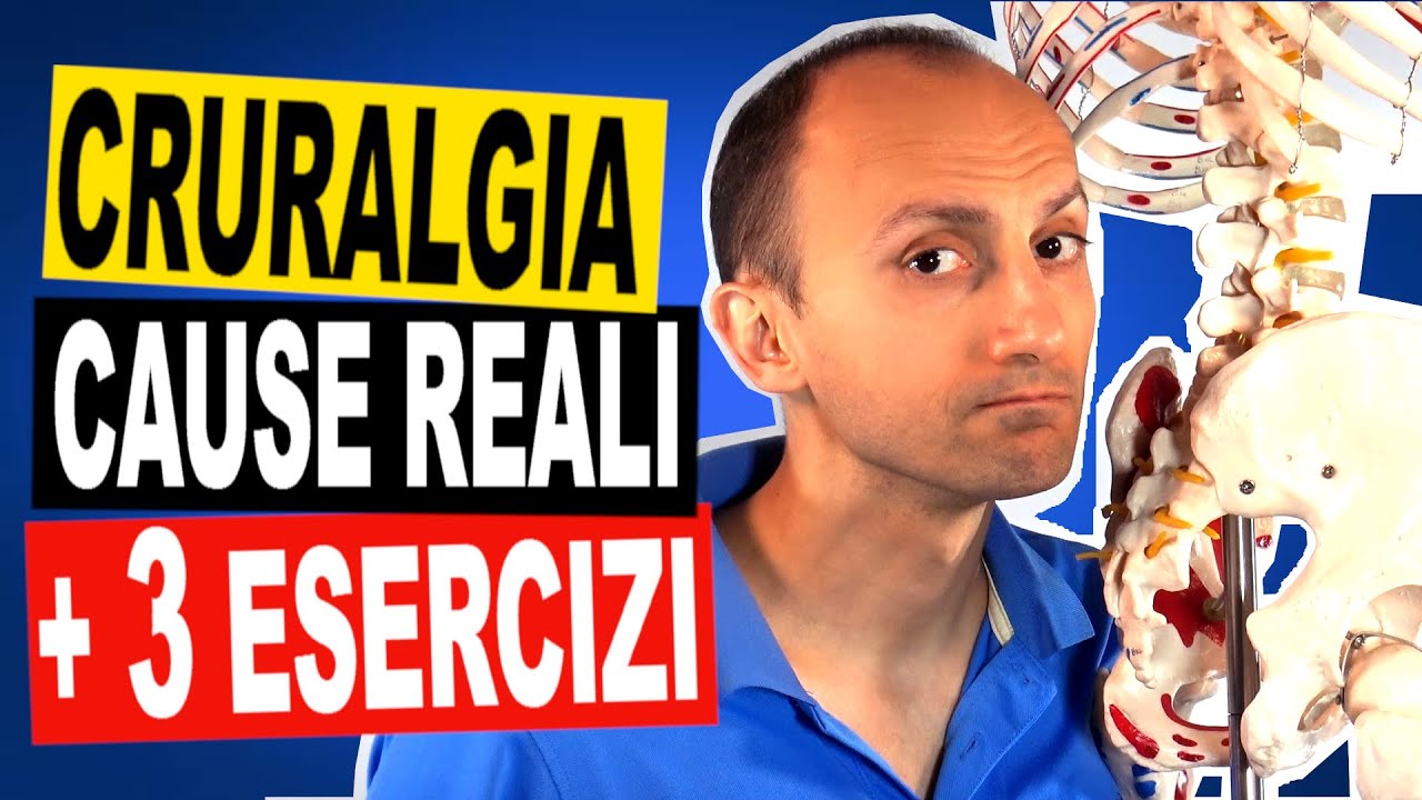 Cruralgia: la Causa e 3 Esercizi di Fisioterapia - YouTube