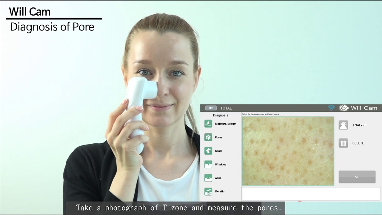 WillCam_Skin Diagnosis System - YouTube